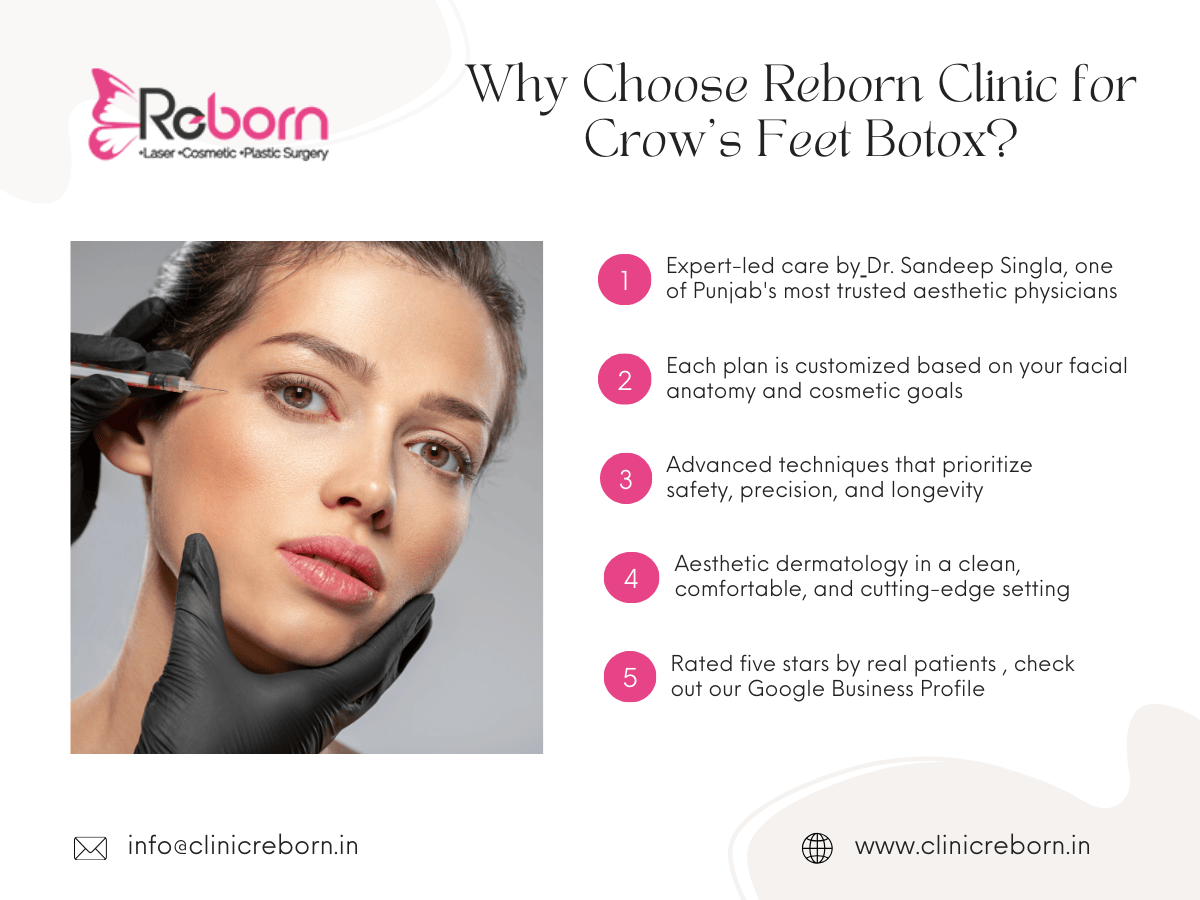 Smooth Out Crow’s Feet with Botox | Clinic Reborn