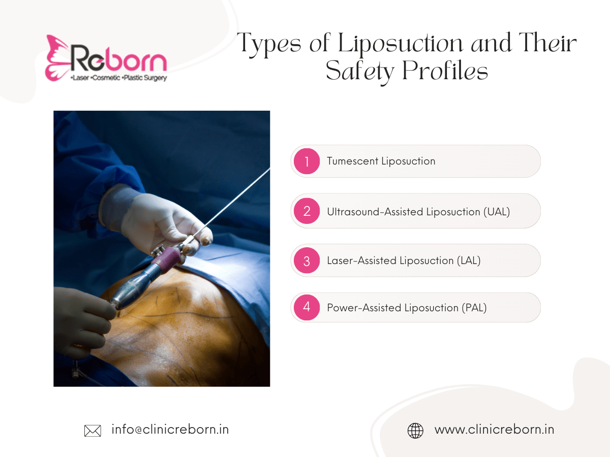 Is Liposuction Safe? Risks & Recovery Guide | Clinic Reborn